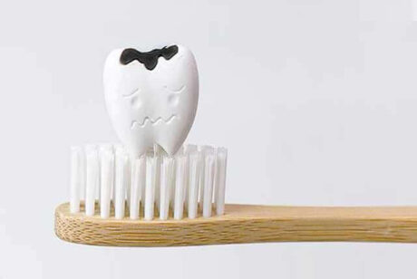 もう虫歯になっていても予防は大事ですか？｜茨木クローバー歯科よくあるご質問